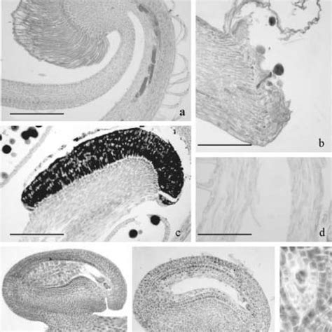 Vigna Adenantha A D Longitudinal Section Of Developing Ovules Download Scientific Diagram