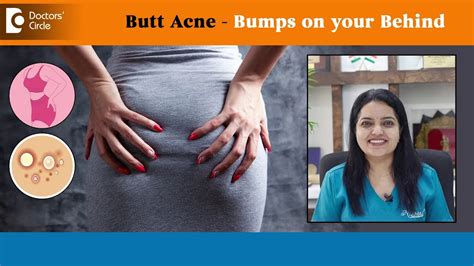 Butt Acne Acne Bumps On Your Back Causes And Treatment Dr Urmila