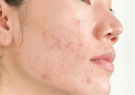 Why Is My Skin So Bad — Moody Sisters Skincare