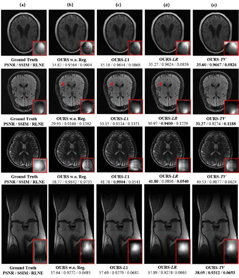 Implicit Neural Representation Based Mri Reconstruction Method With Sensitivity Map Constraints