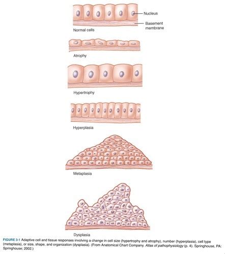 Hypertrophy Hypotrophy Cells