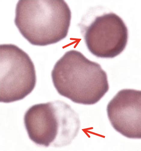 Lecture 5 Erythrocytes Function And Normal Abnormal Distribution Flashcards Quizlet