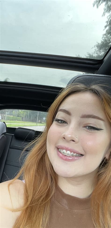 I Love Braces Ramdom Rilovebraces I Love Braces Ramdom Rilovebraces