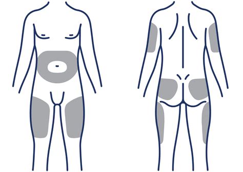 Dosing And Administration Sublocade® Buprenorphine Extended Release Hcp