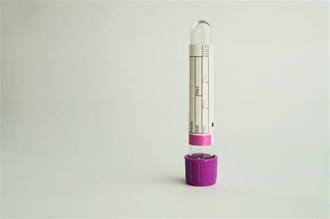 흰색 배경에 수집 및 혈액 샘플을위한 진공 튜브 보라색 뚜껑이 있는 투명 데이터를 식별하려면 레이블을 지정합니다 선택적 초점 뚜껑 0명에 대한 스톡 사진 및 기타 이미지