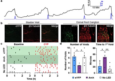 A Wireless Closed Loop System For Optogenetic Peripheral Neuromodulation Pmc
