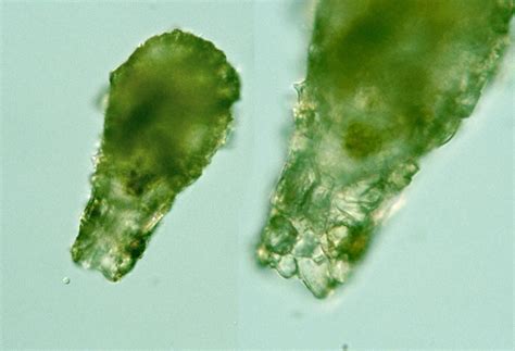Protist Images Difflugia Oblonga