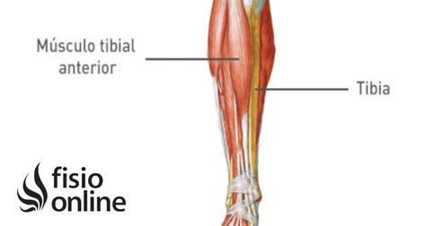 Músculo Tibial Posterior Tendinitis Tibial Posterior Diagnóstico Y