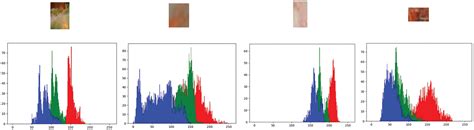 Cmc Free Full Text Fire Detection Algorithm Based On An Improved Strategy Of Yolov5 And