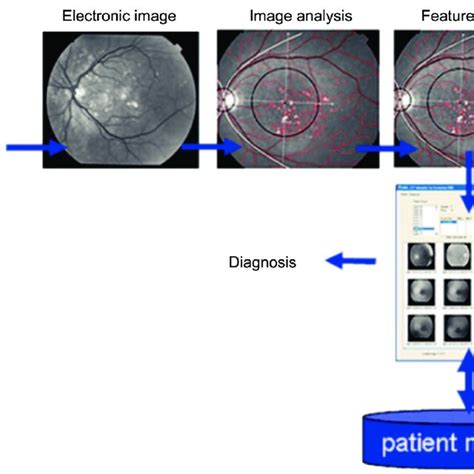 a fundus image is submitted to locate anatomic structures and lesions