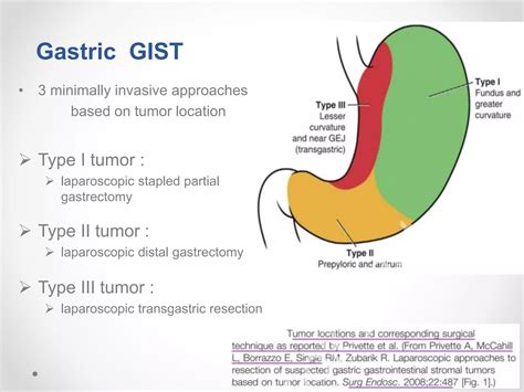 Gastrointestinal Stromal Tumour Gist D1 Pptx Digestive Disorders Diseases And Conditions