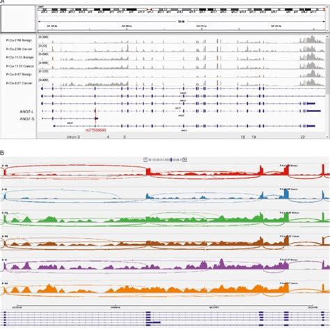 Rna Seq From Prostate Tissue Reveals Aberrant Rna Splicing In The Exons