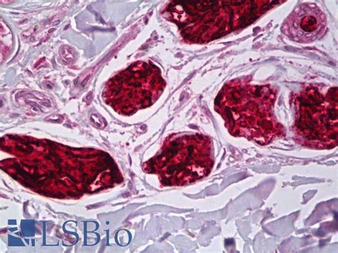 Ihc Plus™ Dcd Dermcidin Monoclonal Antibody Mouse Anti Human Lsbio