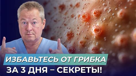 Как НАВСЕГДА избавиться от грибка в 2025 году Youtube