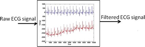Ecg Preprocessing Flow Diagram Download Scientific Diagram