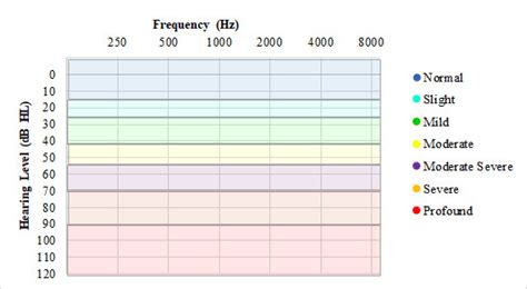 Normal Hearing Range Graph