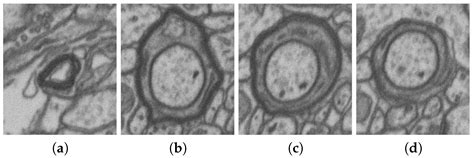 Ai Diffusion Model Based Technology For Automating The Multi Class Labeling Of Electron