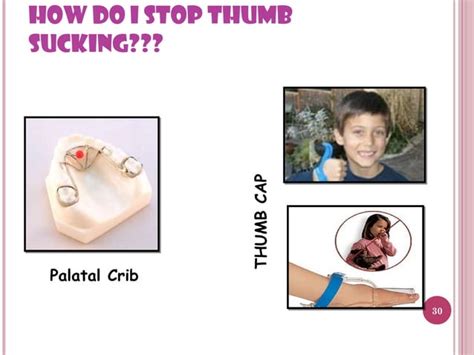 Oral Habits Pedodontics Ppt