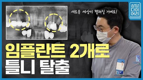 최단기간 최소 임플란트의 비밀 Youtube