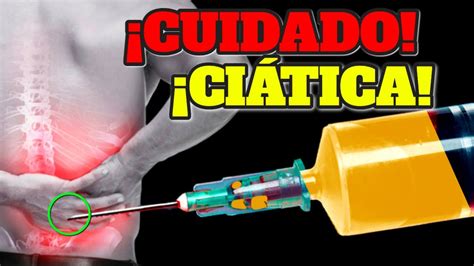 Tenho Alergia a Penicilina Desenvolvi alergia também a Eritromicina e Azitromicina Tem relação