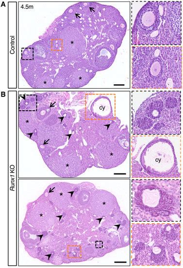 Loss Of Runx1 Induces Granulosa Cell Defects And Development Of Ovarian Tumors In The Mouse