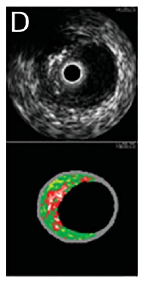 Four Cross Sectional Images From Proximal To Distal Within The Same Download Scientific Diagram