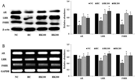 Sex Hormone Receptor Expression Of Androgen Receptor AR Luteinizing