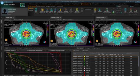 Synthetic Ct Generation In Raystation Ipem Synthetic Ct Generation In Raystation Ipem