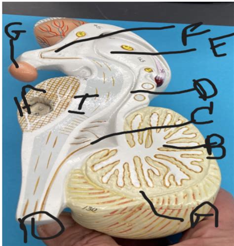 midbrain diagram quizlet