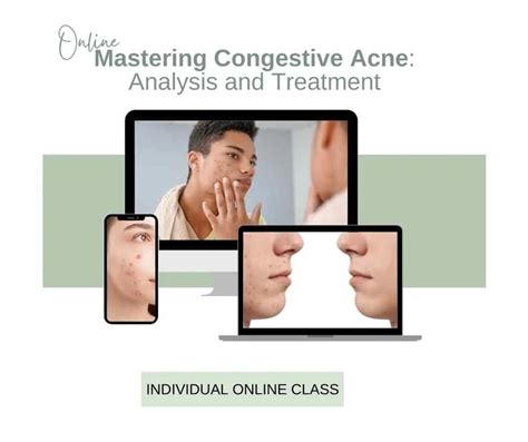 Online Classes Preston Acne Pros