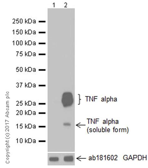 Recombinant Anti Tnf Alpha Antibody Epr20972 Ko Tested Ab215188 Abcam