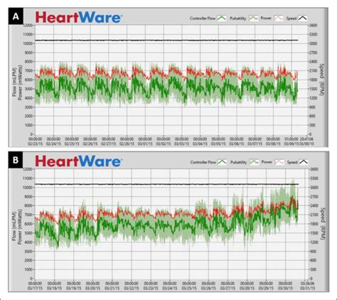 Lvad Parameters And Flow Pulsatility Displayed Over 14 Days Lvad Data Download Scientific