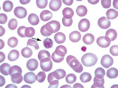 chapter 13 and 14 flashcards quizlet