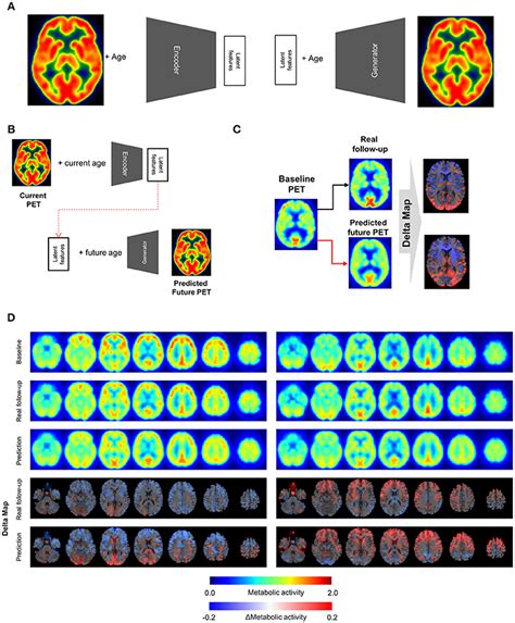 Frontiers Predicting Aging Of Brain Metabolic Topography Using Variational Autoencoder