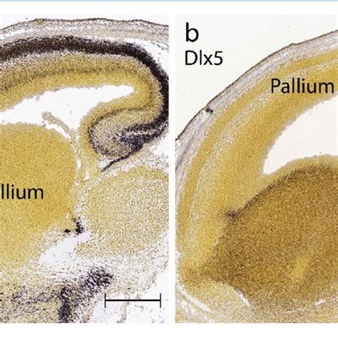 Sagittal Sections Of E15 5 Mouse Brains Showing The Expression Of An Download Scientific