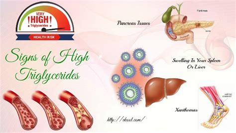 3 Common Signs Of High Triglycerides And Cholesterol