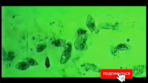 Избавиться от паразитов в домашних условиях Гибель паразитов от биорезонанса Youtube