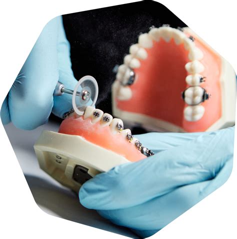 Clear Aligners And Ipr Workshop London Dental Institute