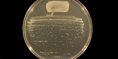 Isolation And Mass Multiplication Of Rhizobium Design Innovation Center