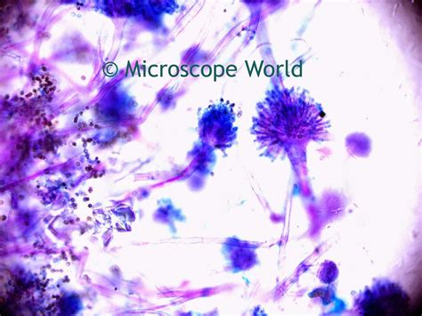 Microscope World Blog Science Project Mold Under The Microscope