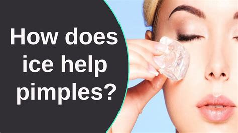 Does Ice Help Blind Pimples