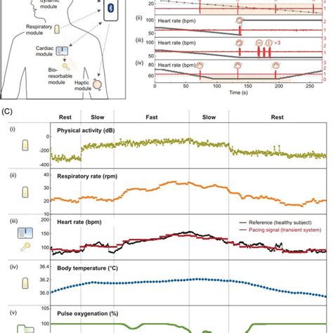 Patient Feedback And Adaptive Pacing Functions A Schematic