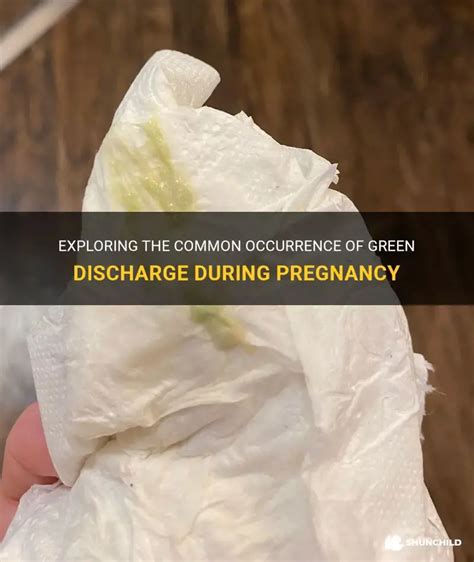 Exploring The Common Occurrence Of Green Discharge During Pregnancy