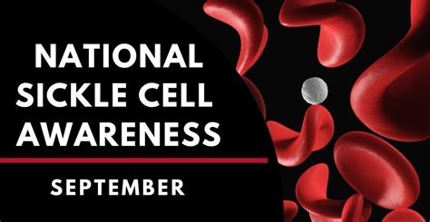 Sickle Cell Anemia September Is Sickle Cell Awareness Month Buffalo Hot Sex Picture