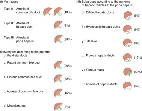 Biliary Atresia And Biliary Hypoplasia Clinical Tree