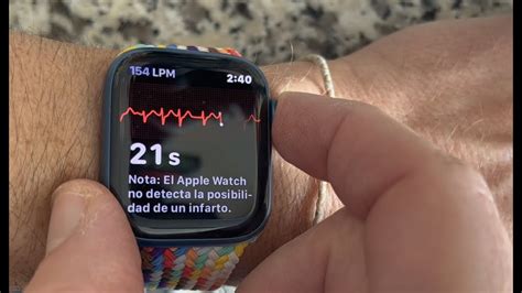 Afib Atrial Fibrillation Ekgecg On Apple Watch Youtube