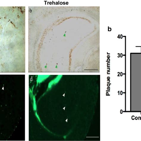 Trehalose Inhibited The Formation Of Neuritic Plaques In App23 Mice A Download Scientific