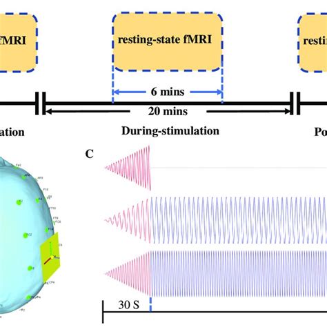 A The Protocol Of Mri Acquisition And Transcranial Alternating