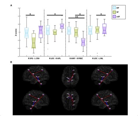 A Notched Box Plots Depicting The Decreased And Increased Connectivity Download Scientific
