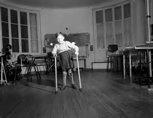 Polio Is Back In The United States How Did That Happen Bulletin Of The Atomic Scientists